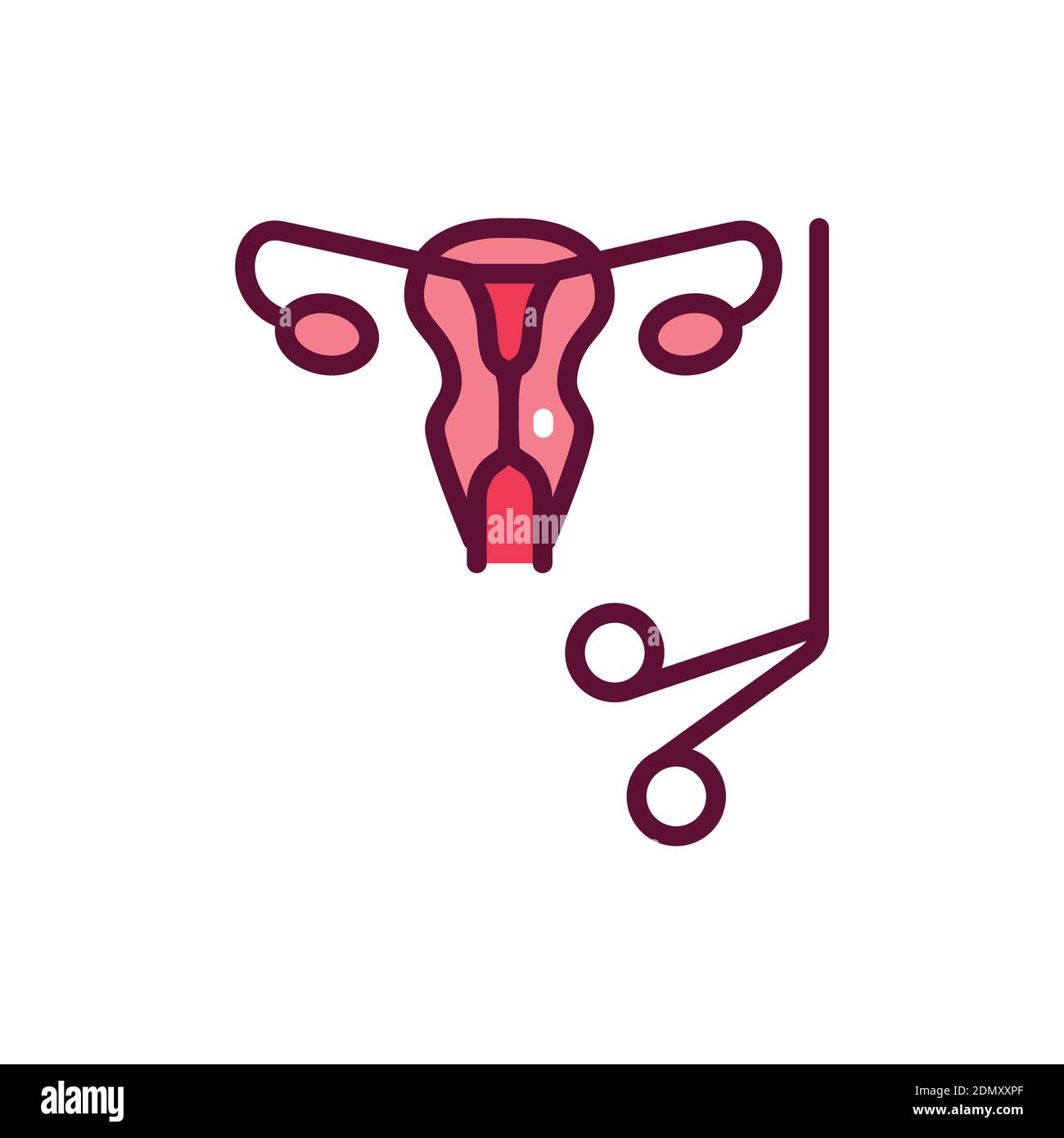 Illustration of anatomy of cervix hi-res stock photography and images ...