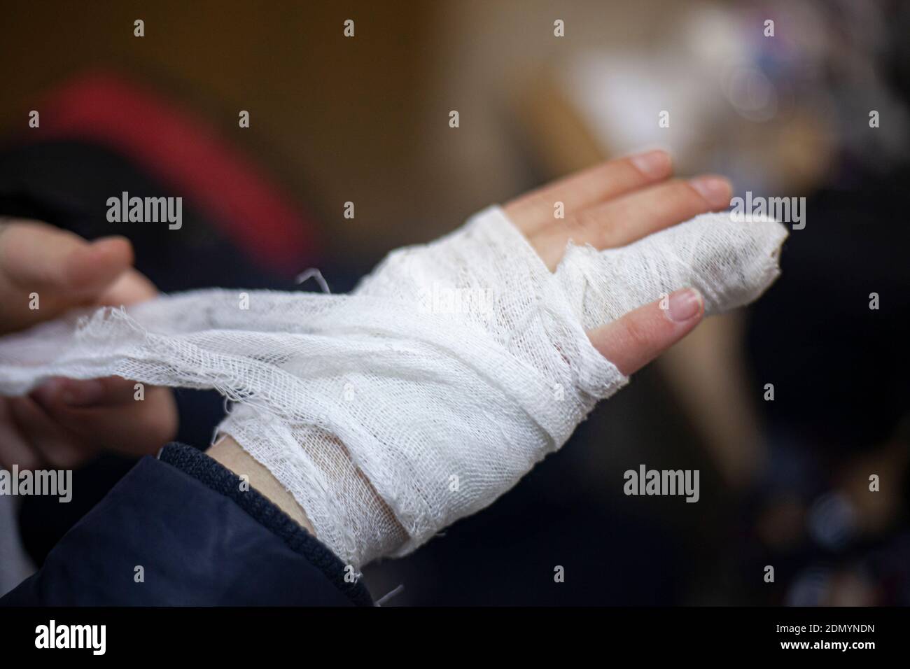 Bone Fusion High Resolution Stock Photography and Images - Alamy