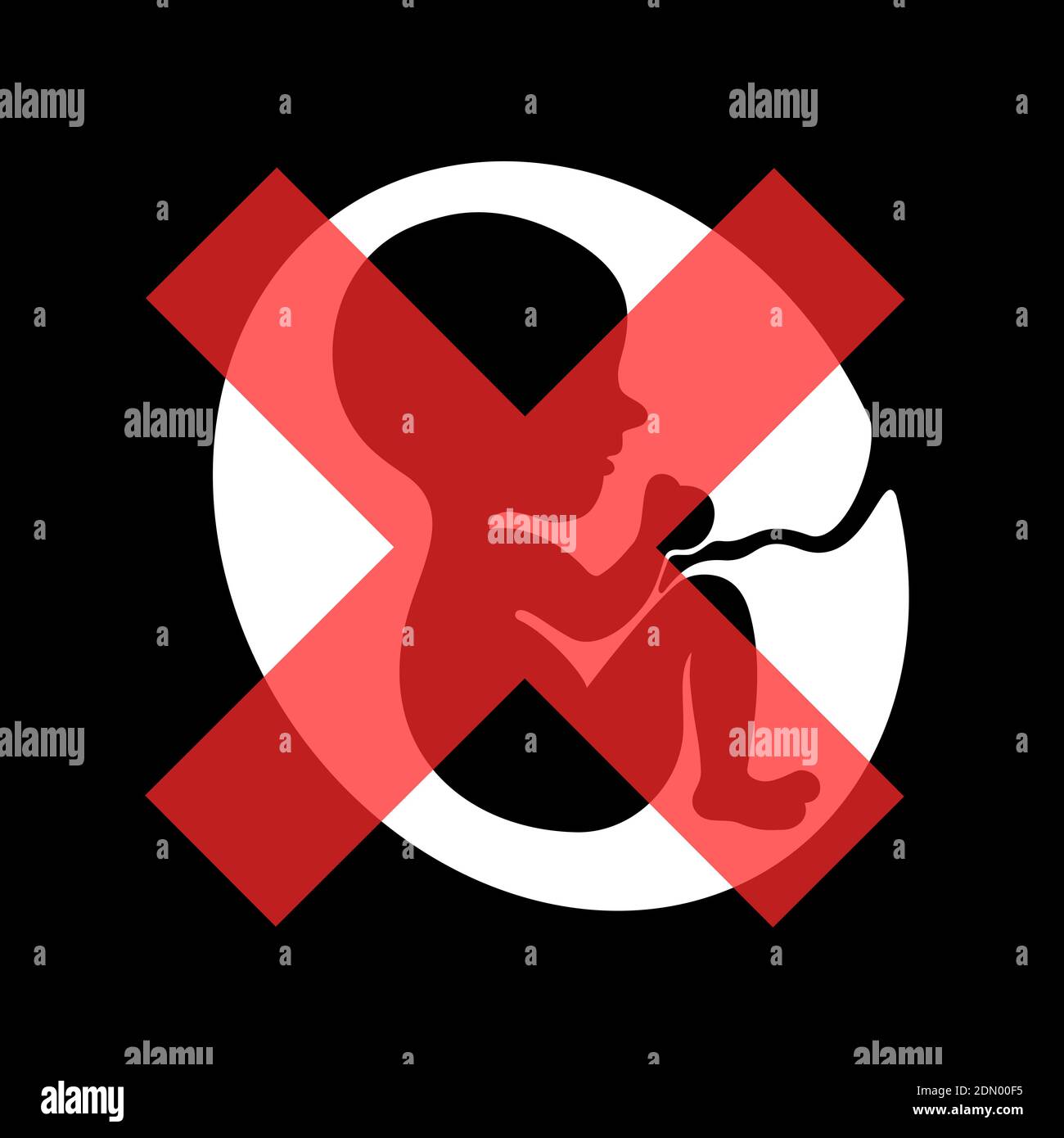 Abortion - fetus, embryo and unborn baby is removed from uterus. Vector ...