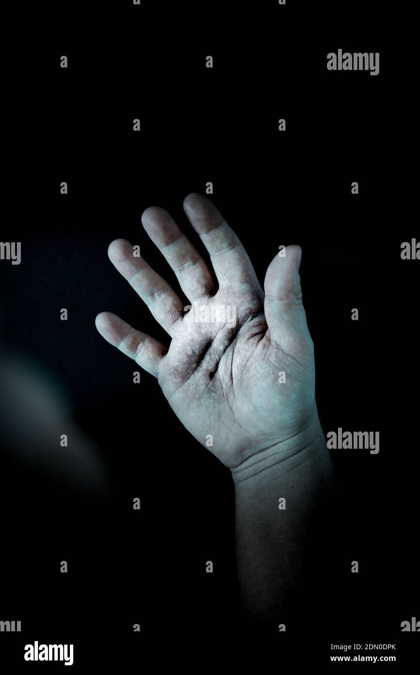 A closeup vertical shot of a violent man's hand palm with an injured ...