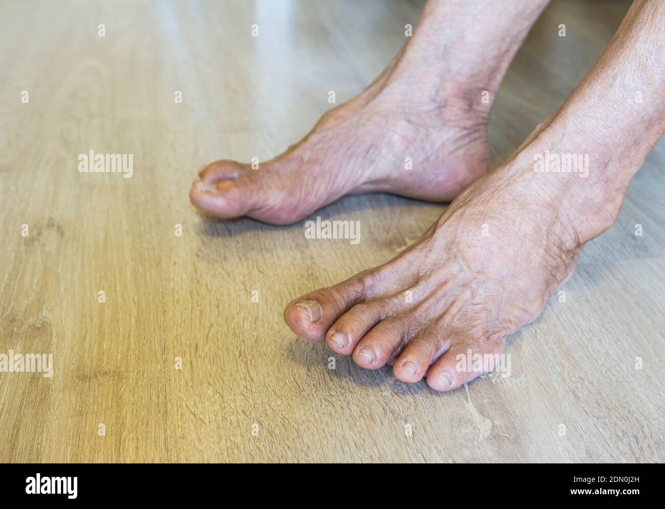 Wizened Skin High Resolution Stock Photography and Images - Alamy