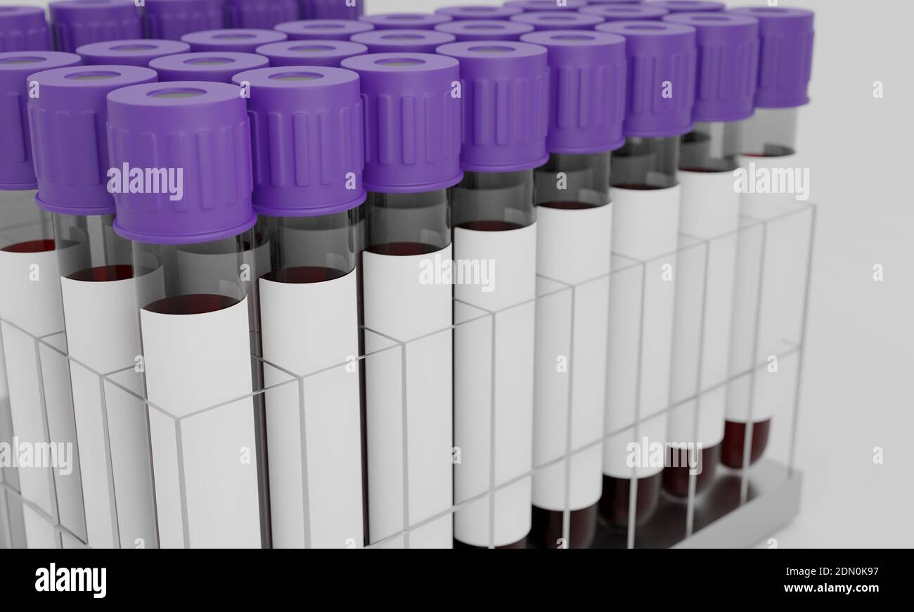 Blood clot test hi-res stock photography and images - Alamy