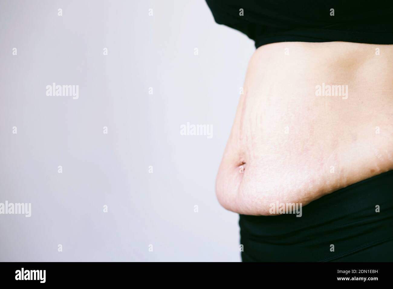 Scratch belly hi-res stock photography and images - Alamy