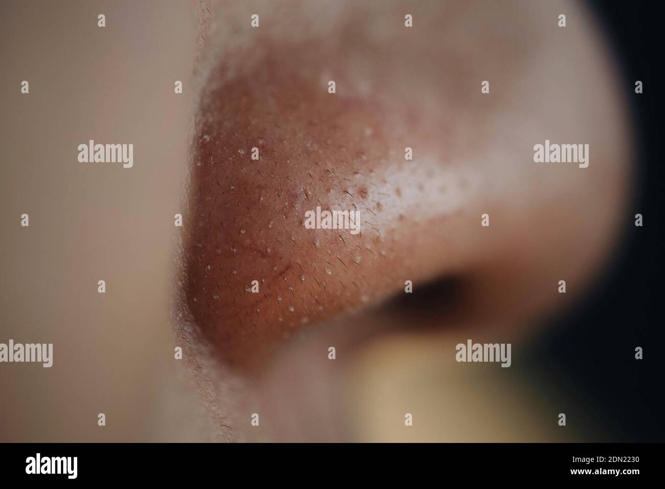 Close-up Of Human Nose Stock Photo - Alamy