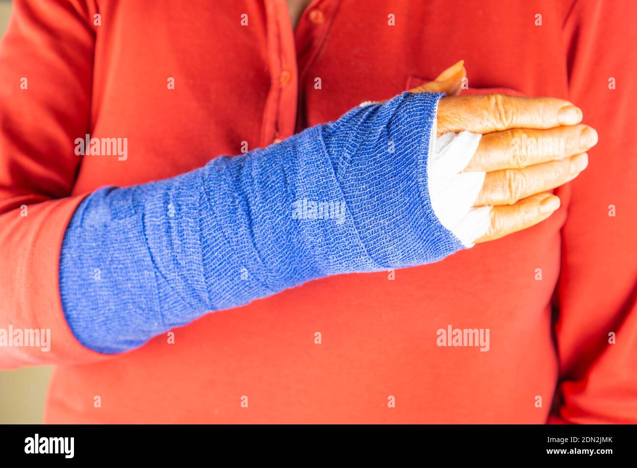 Fracture hand High Resolution Stock Photography and Images - Alamy