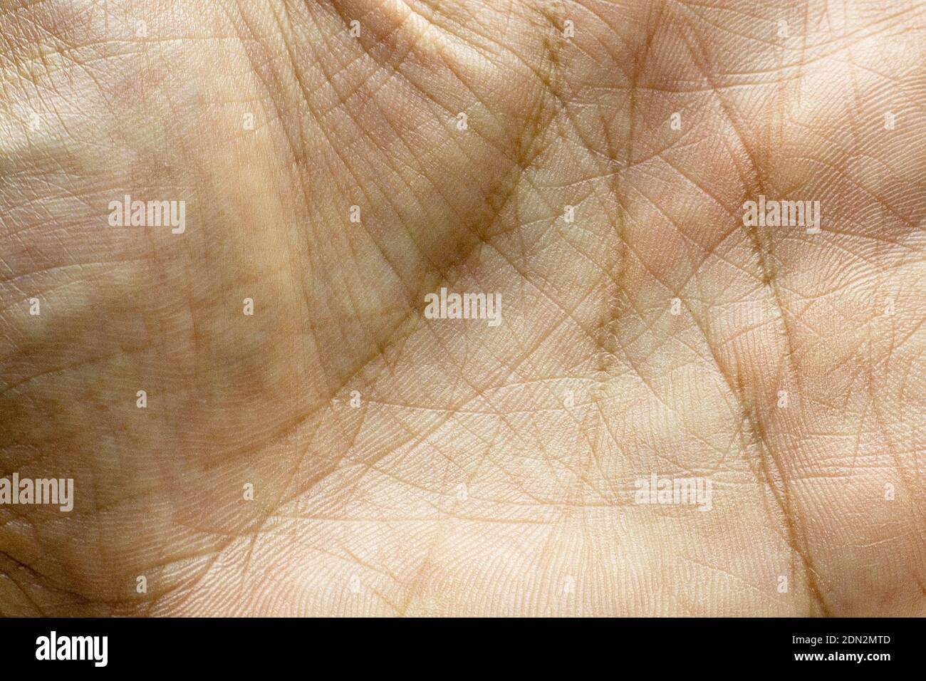 Human Skin Texture Black High Resolution Stock Photography and Images ...