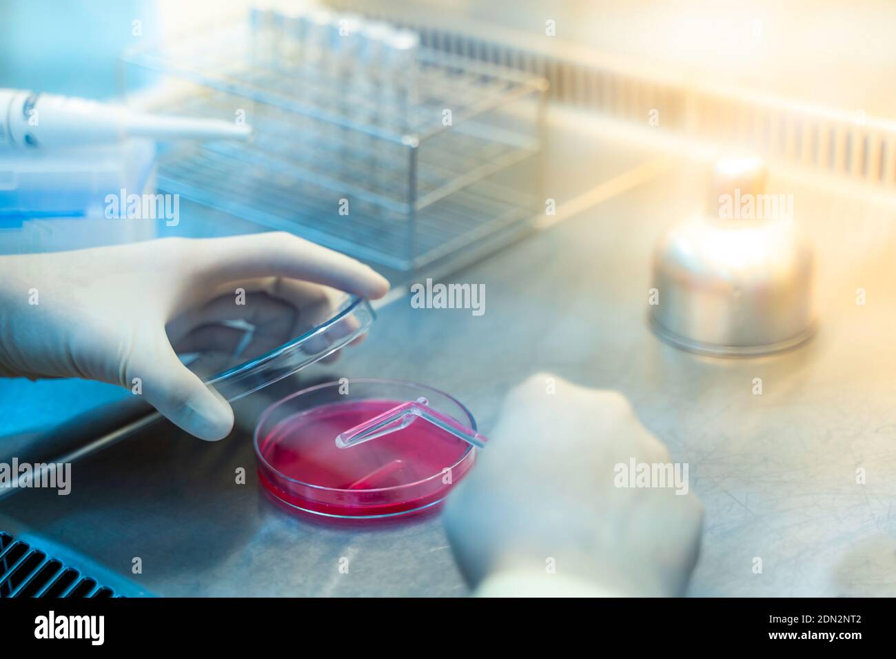 Bacteria Gram Positive And Negative High Resolution Stock Photography ...