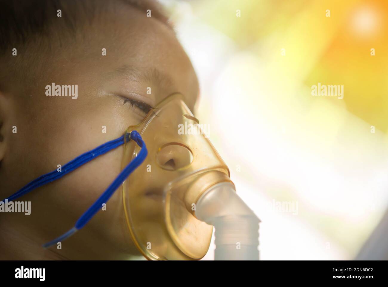 Baby oxygen mask hi-res stock photography and images - Alamy