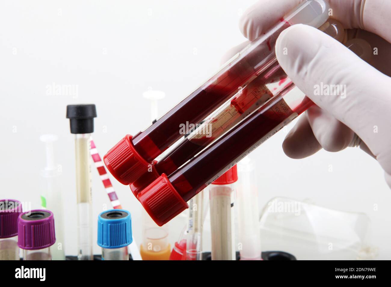 Micro biology vial hi-res stock photography and images - Alamy