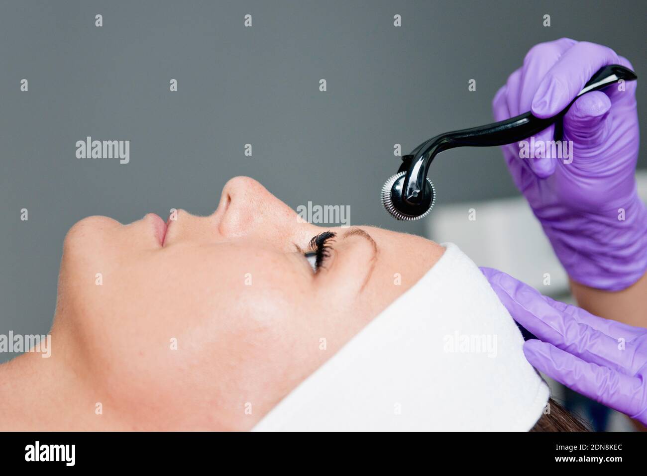Collagen Induction Therapy High Resolution Stock Photography and Images ...
