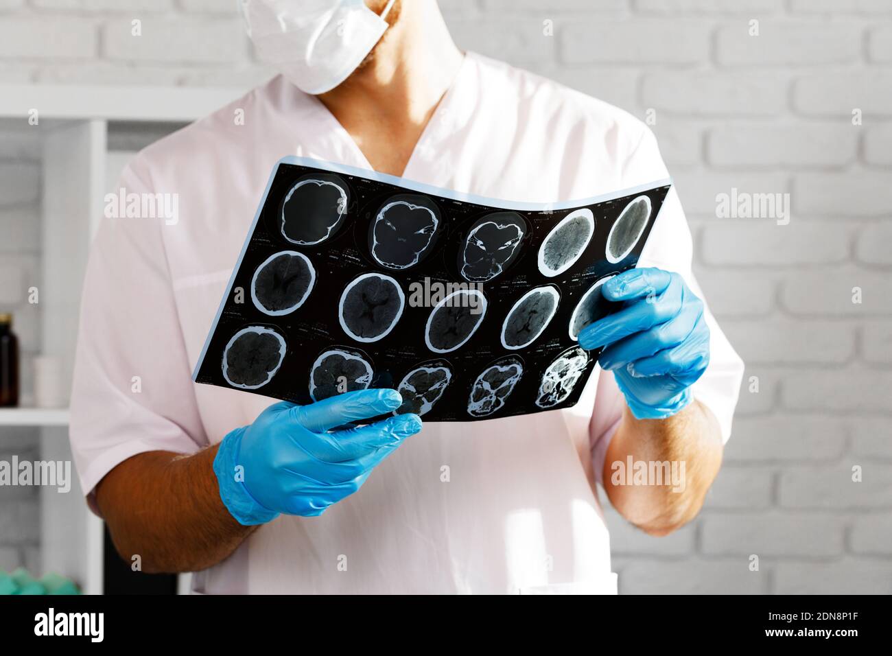 Male doctor examines MRI brain scan of a patient Stock Photo - Alamy