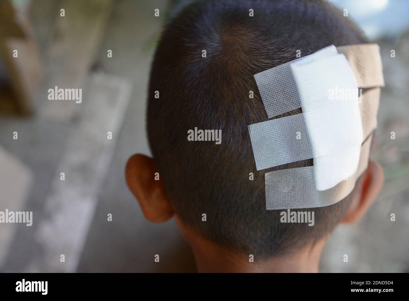 Boy head bandage hi-res stock photography and images - Alamy