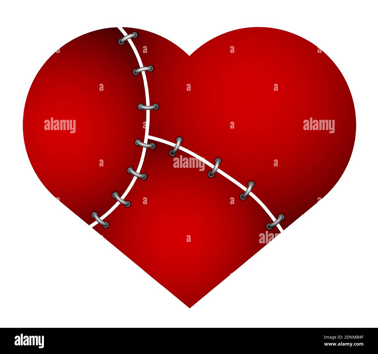 Broken heart with a wound sewn up with wire. Problems in family ...