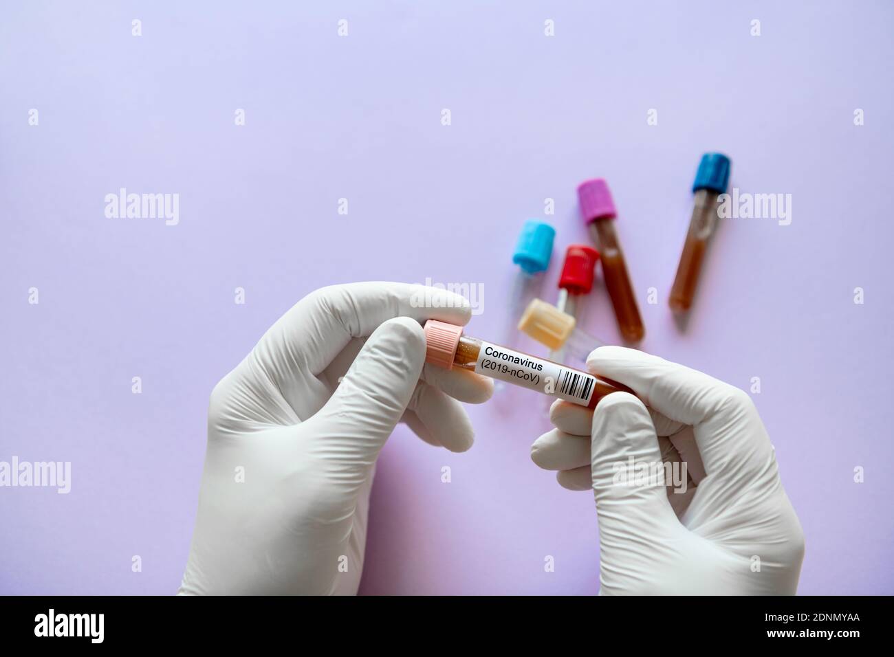 Bacteria blood test hi-res stock photography and images - Alamy
