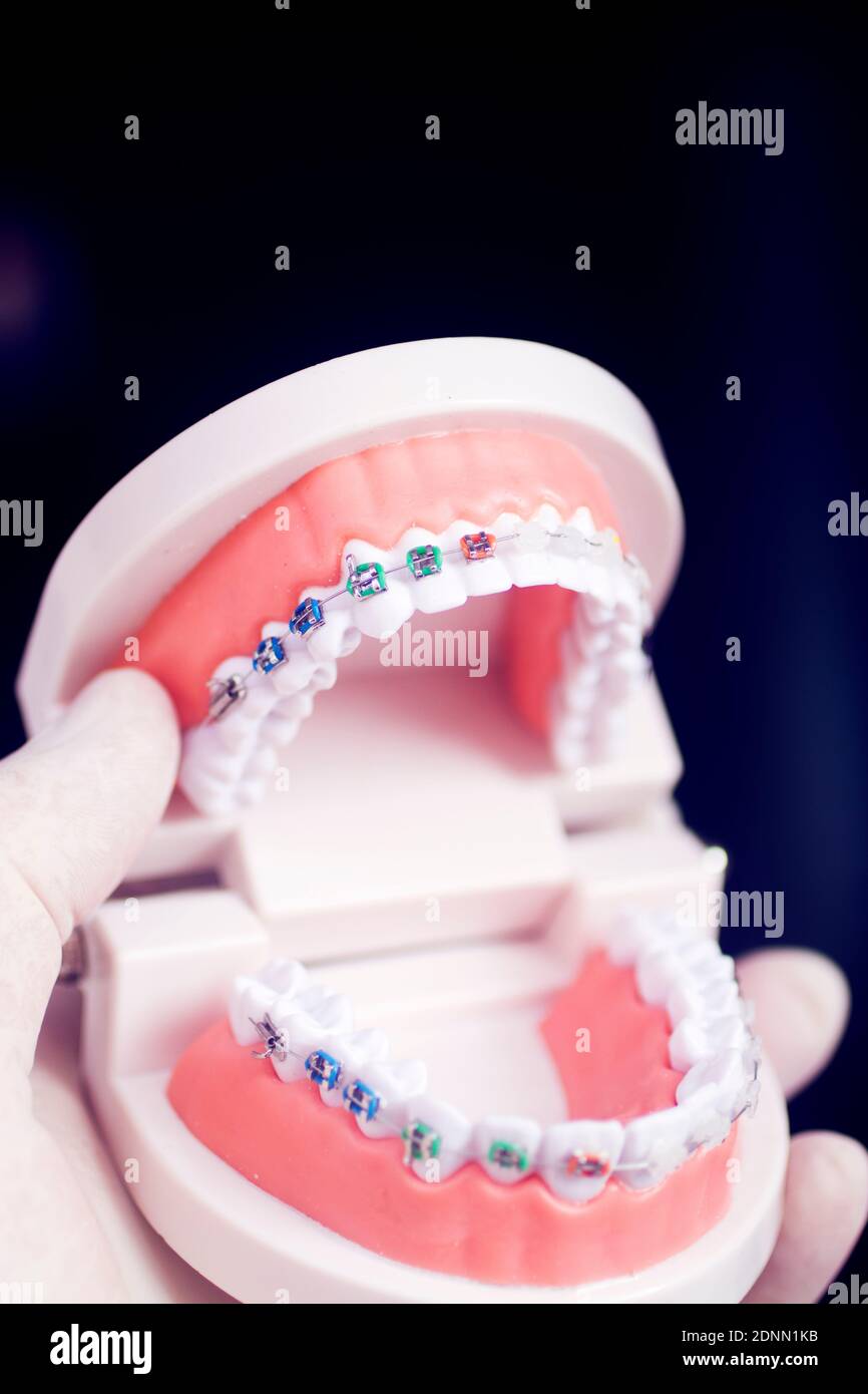 Dental teeth aligner bracket teaching student model showing gums and ...
