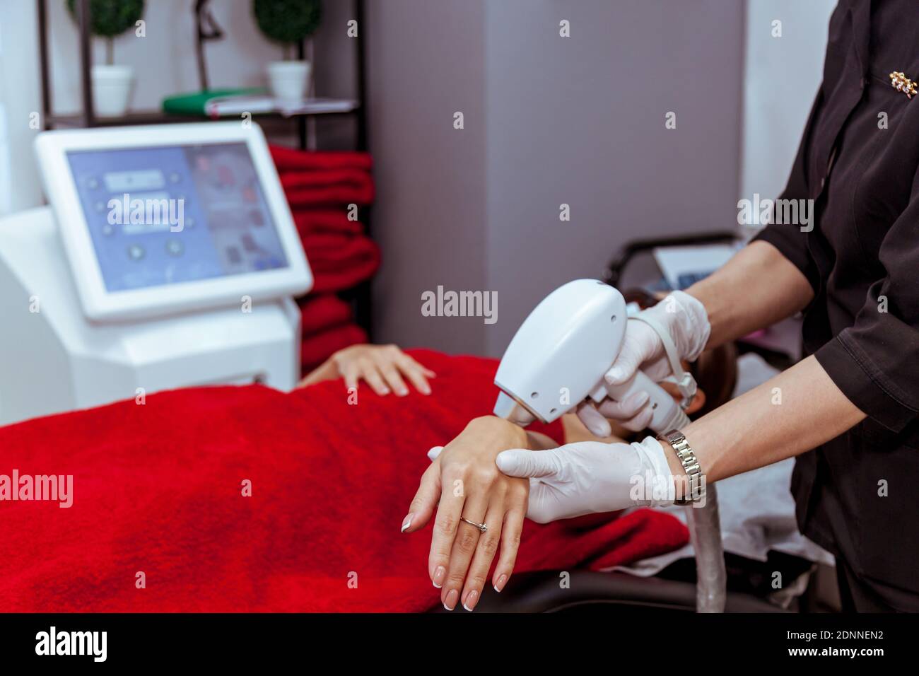 Hardware hair removal procedure on the girl's body. A beautician does ...