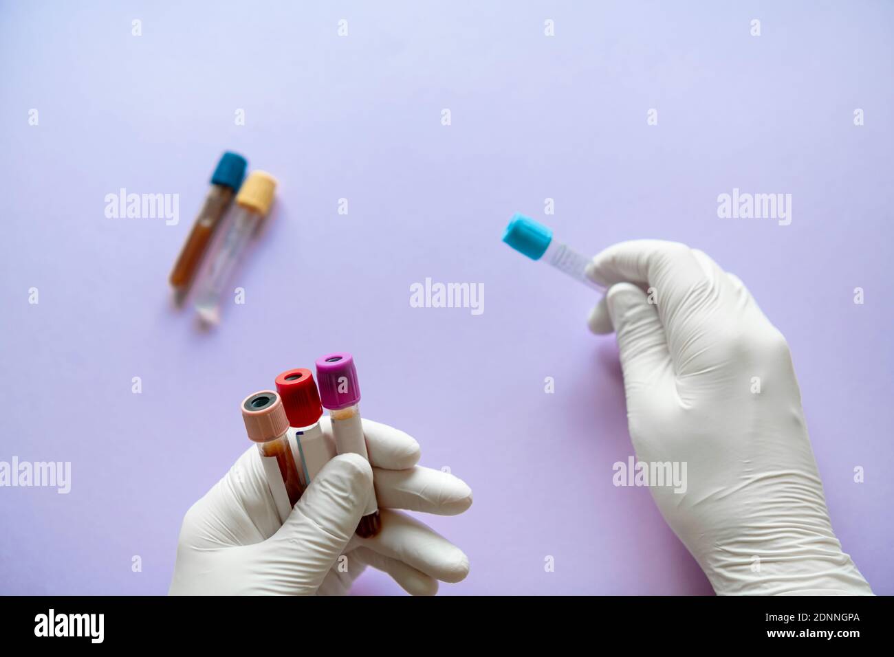 Hands in surgical gloves holding medical samples Stock Photo - Alamy