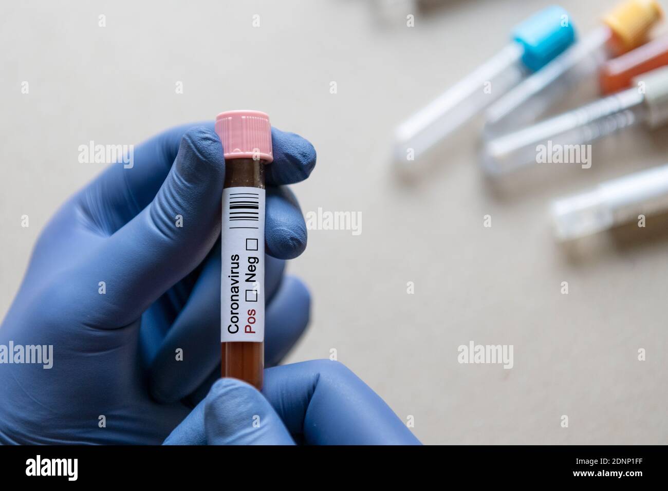 Hands in surgical gloves holding medical samples Stock Photo - Alamy