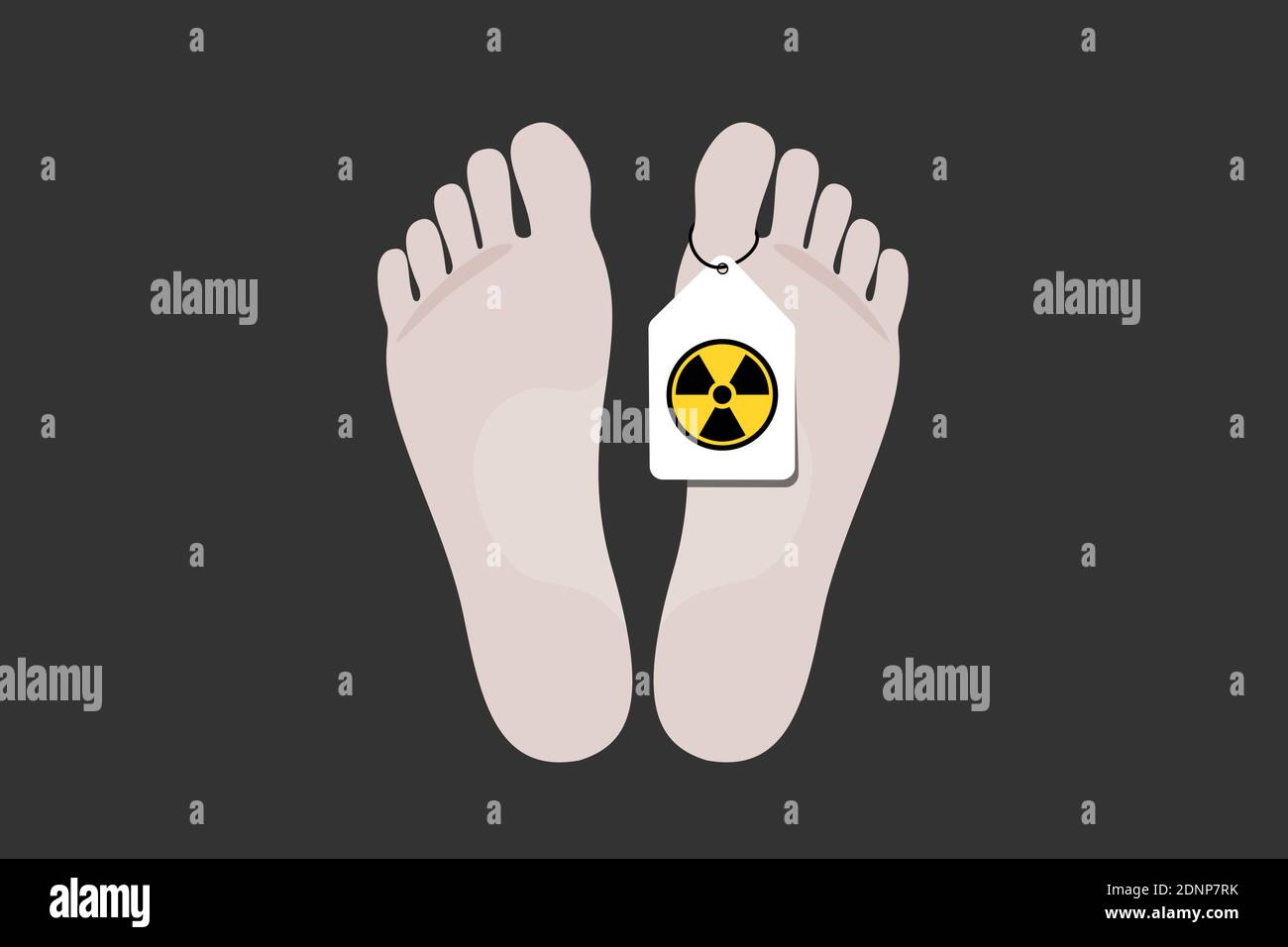 Nuclear radiation and irradation killed a human person - deceased body ...