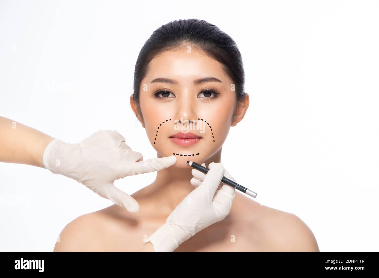 Woman plastic surgery markings on hi-res stock photography and images ...