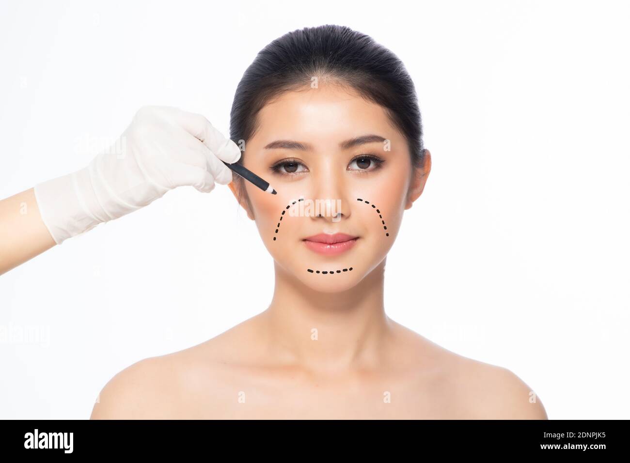 Surgical marking hi-res stock photography and images - Alamy