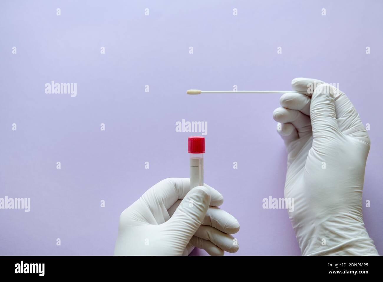 Hands in surgical gloves holding medical sample Stock Photo - Alamy