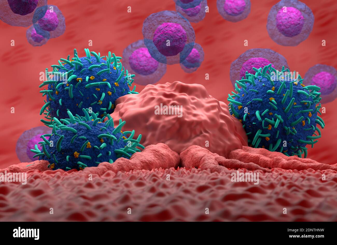 T-cells attack cancer tumor 3D render illustration closeup Stock Photo ...