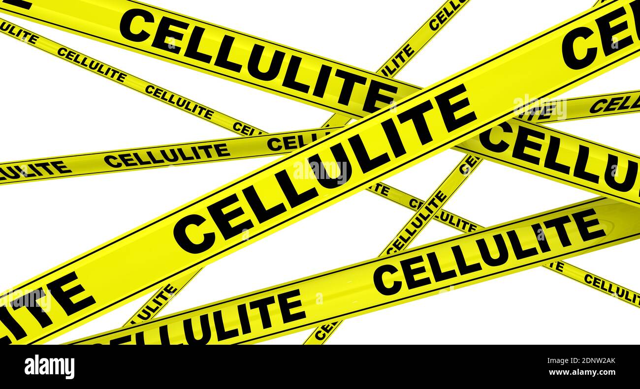 Cellulite. Yellow warning tapes with black text CELLULITE. Isolated. 3D ...