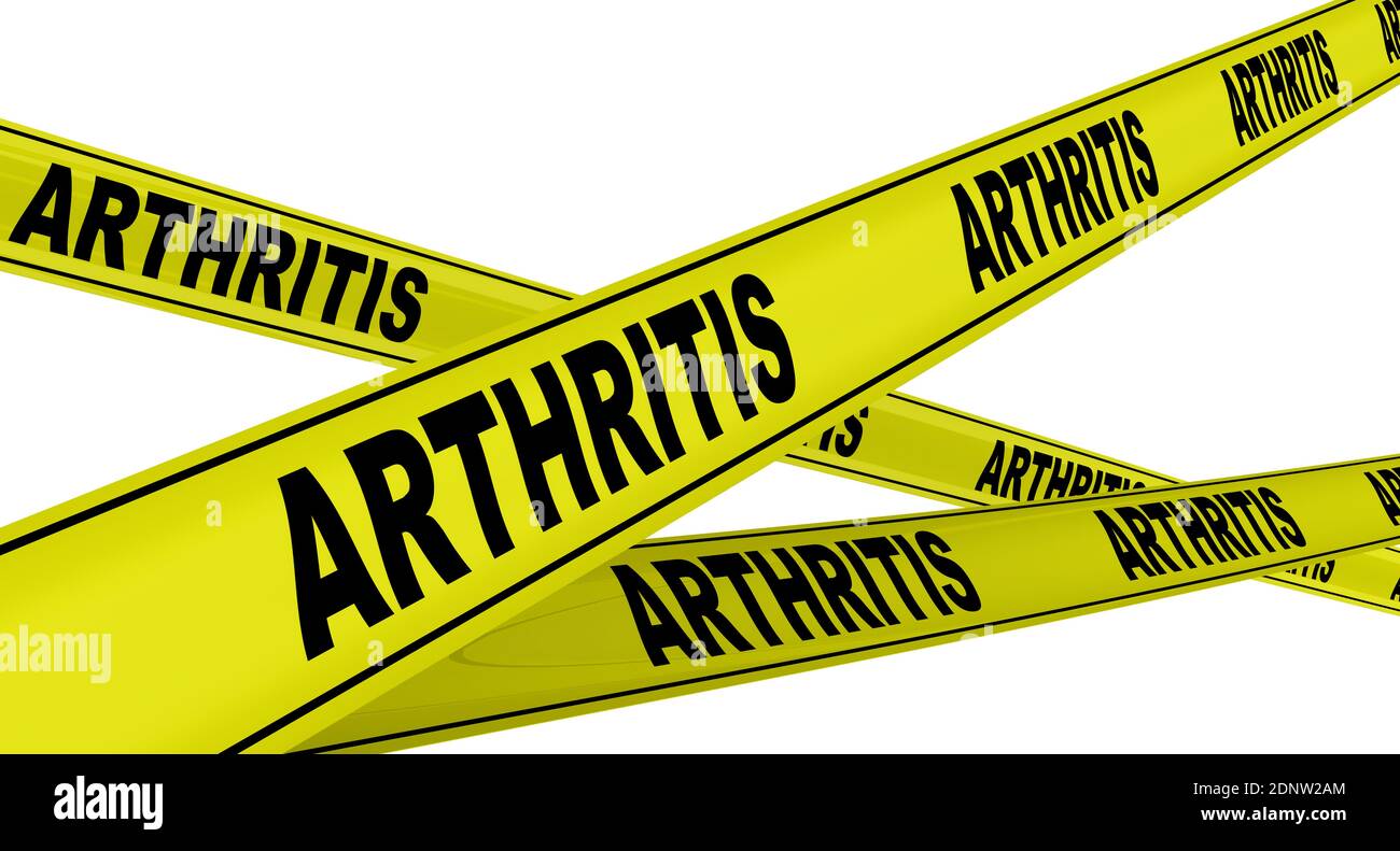 Arthritis. Yellow warning tapes with black words ARTHRITIS (mean any ...