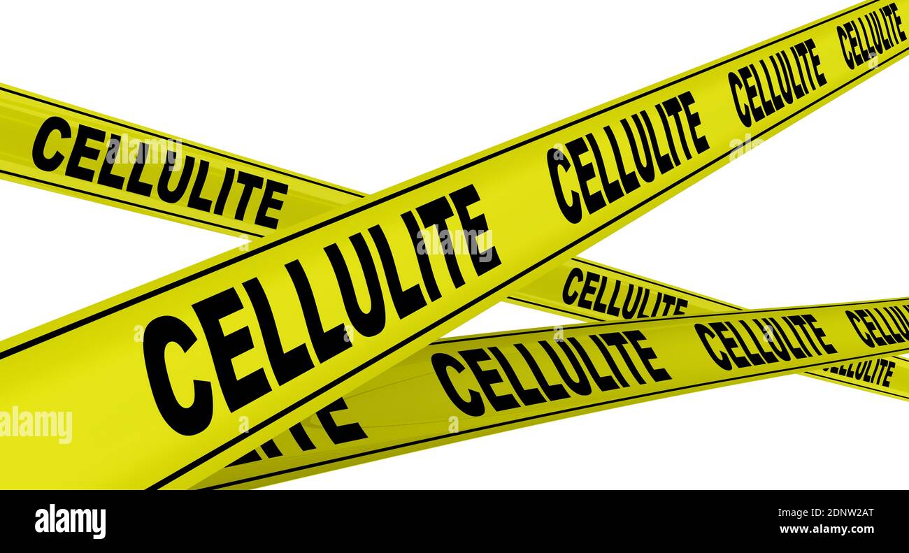 Cellulite. Yellow warning tapes with black text CELLULITE. Isolated. 3D ...