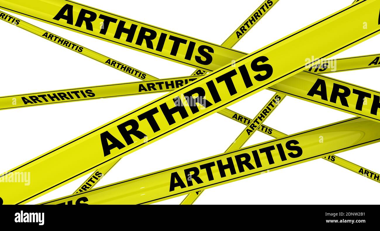 Arthritis. Yellow warning tapes with black words ARTHRITIS (mean any ...