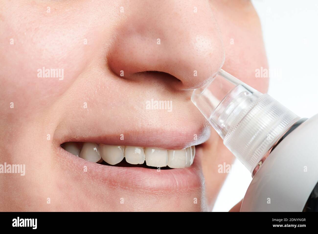 Remove teeth woman hi-res stock photography and images - Alamy