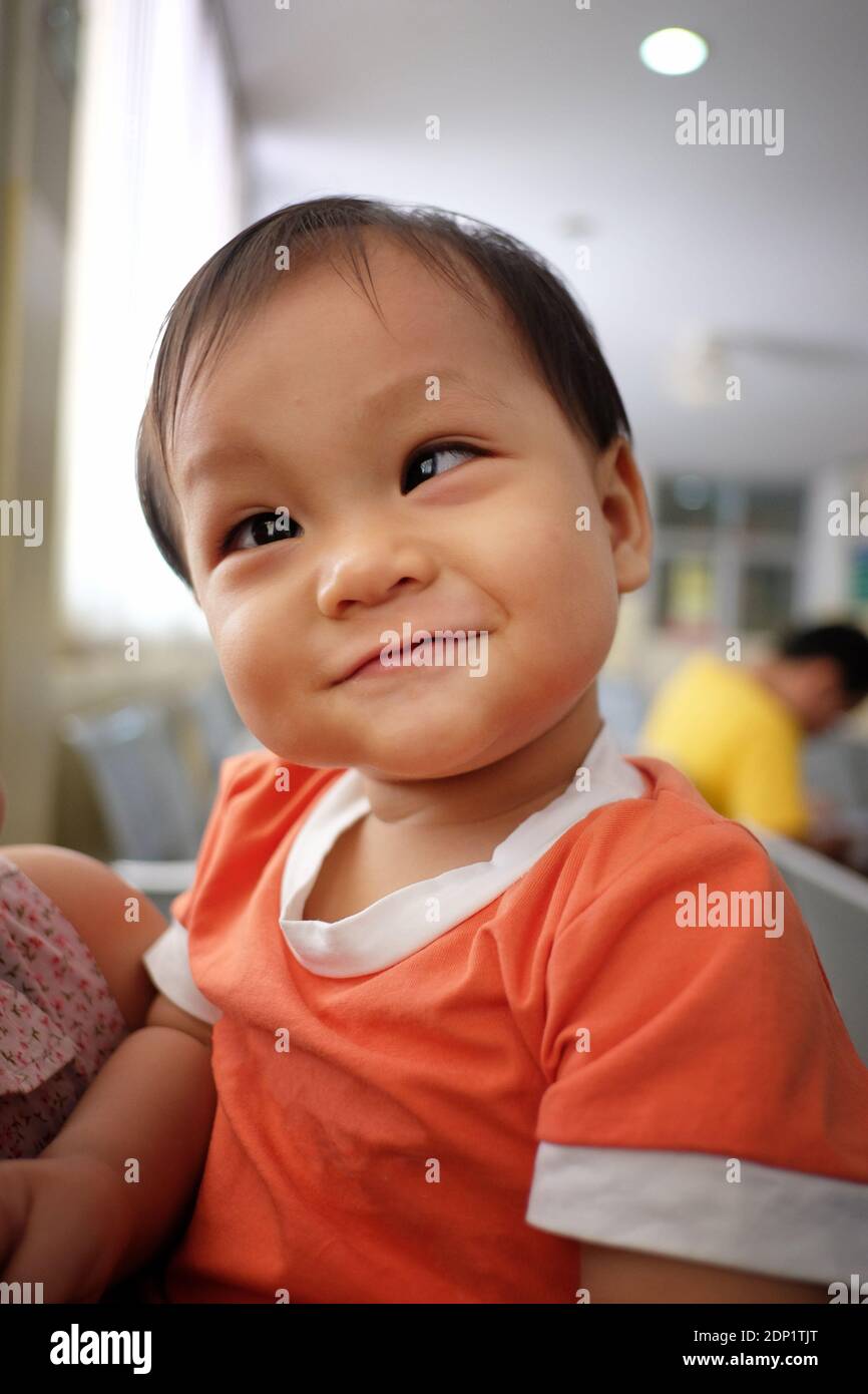 Strabismus infant hi-res stock photography and images - Alamy