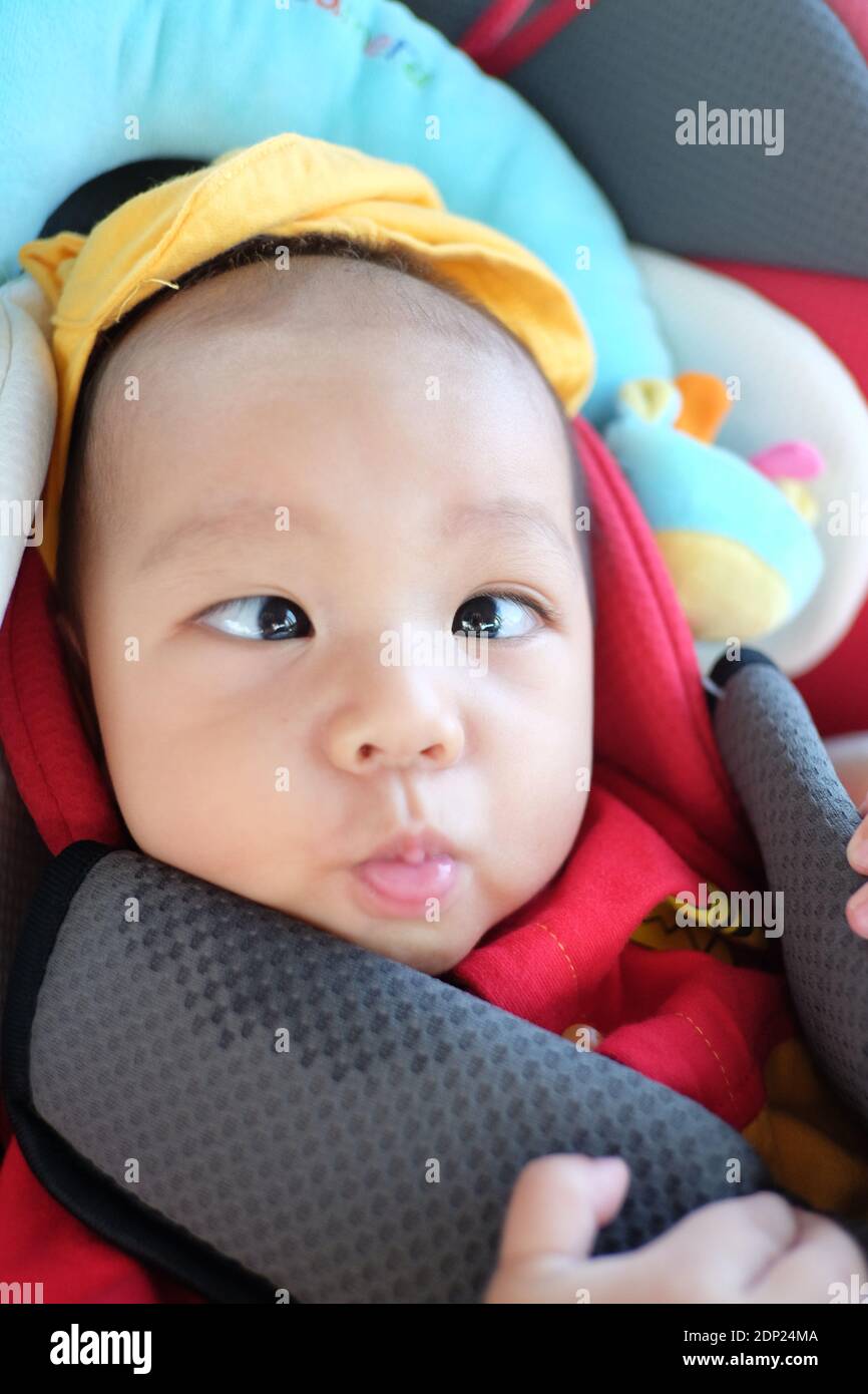 Strabismus infant hi-res stock photography and images - Alamy