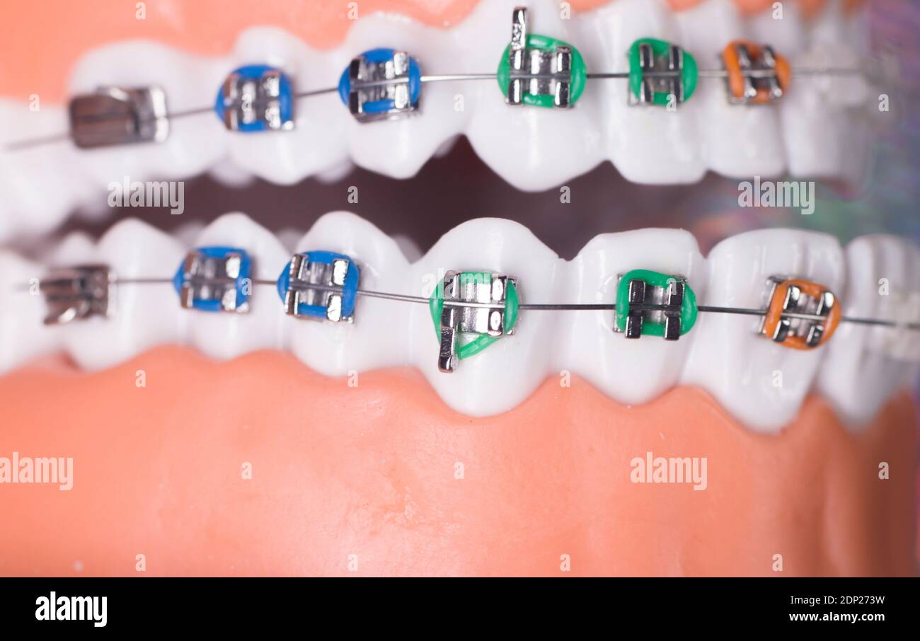 Plastic retainers hi-res stock photography and images - Alamy