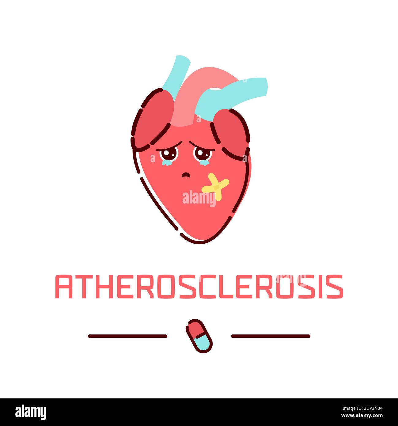 Atherosclerosis, conceptual illustration Stock Photo - Alamy Atherosclerosis, conceptual illustration Stock Photo - Alamy