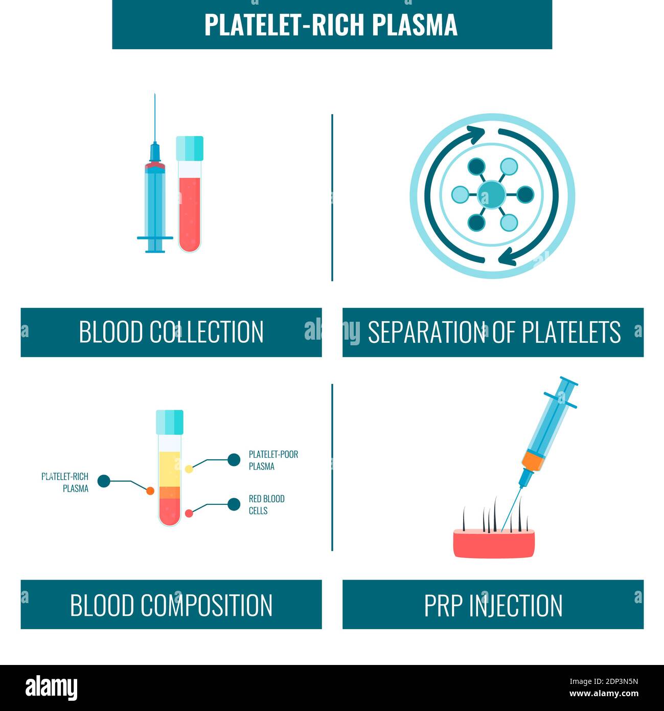 Plasma replacement hi-res stock photography and images - Alamy