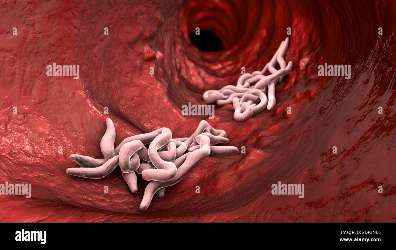 Parasitic roundworm species hi-res stock photography and images - Alamy