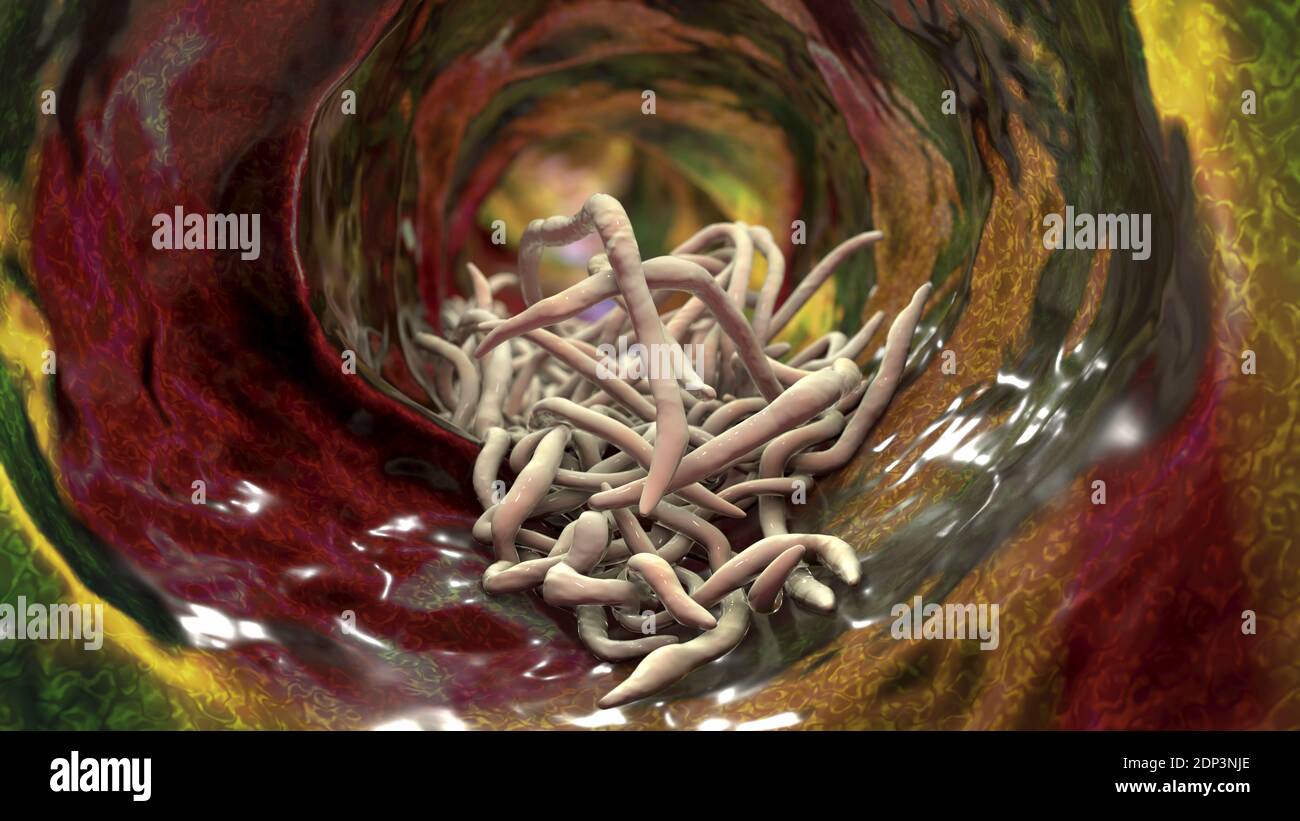 Worms Living In Humans at Patricia Logan blog