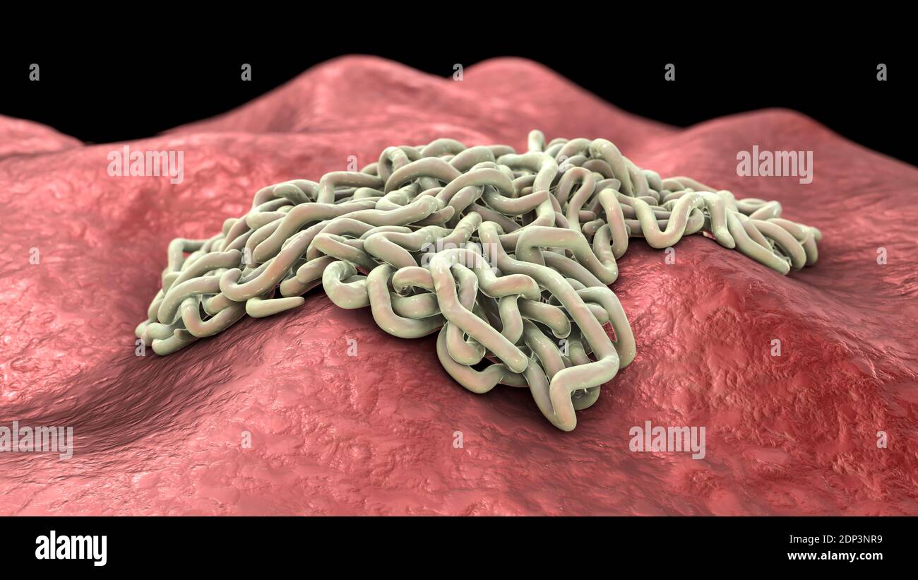 Round worms, computer illustration. Roundworms, or nematodes, include ...