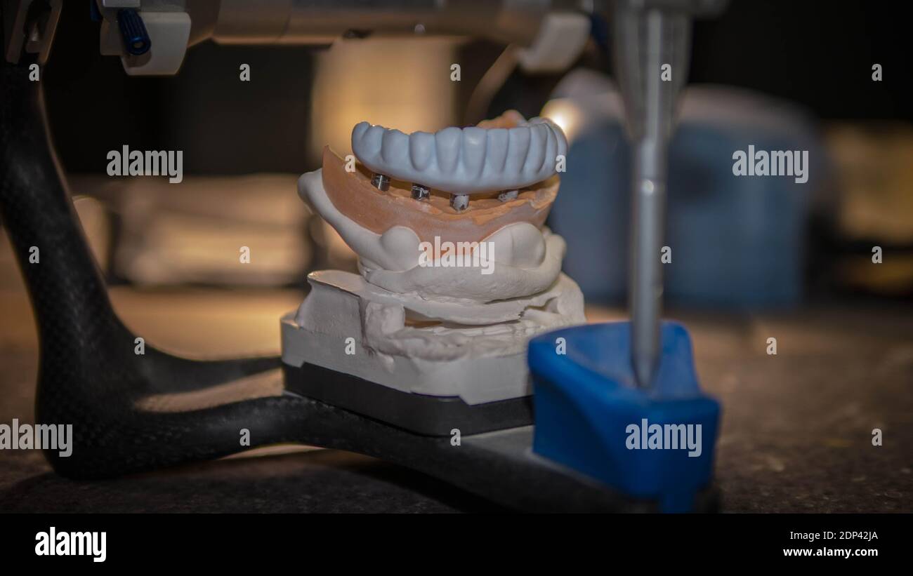 Dental technician tools, dental prosthetics. Dental prosthetics ...