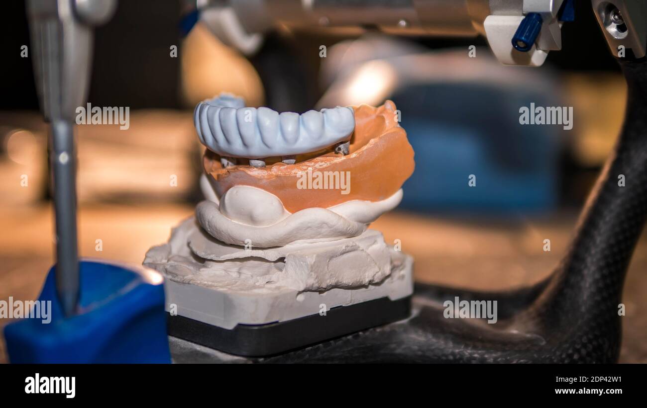 Dental prosthetics, model with installed teeth in the prosthesis ...