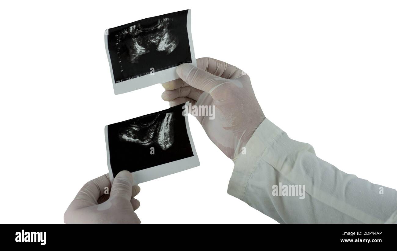 Ultrasound of a male prostate in the hands of a doctor isolated on a ...