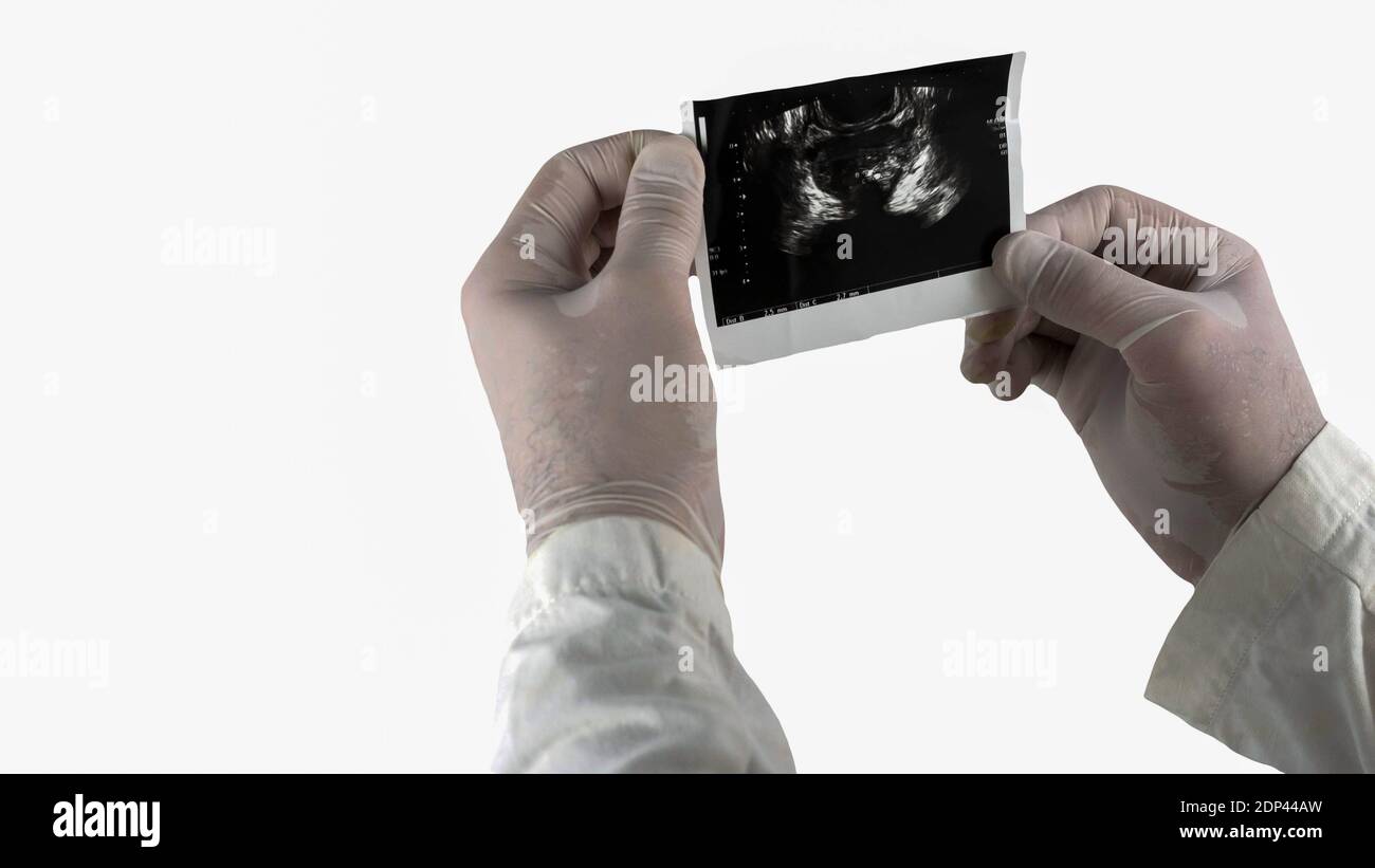 Ultrasound of the prostate at the doctor's hands, a picture of a male ...