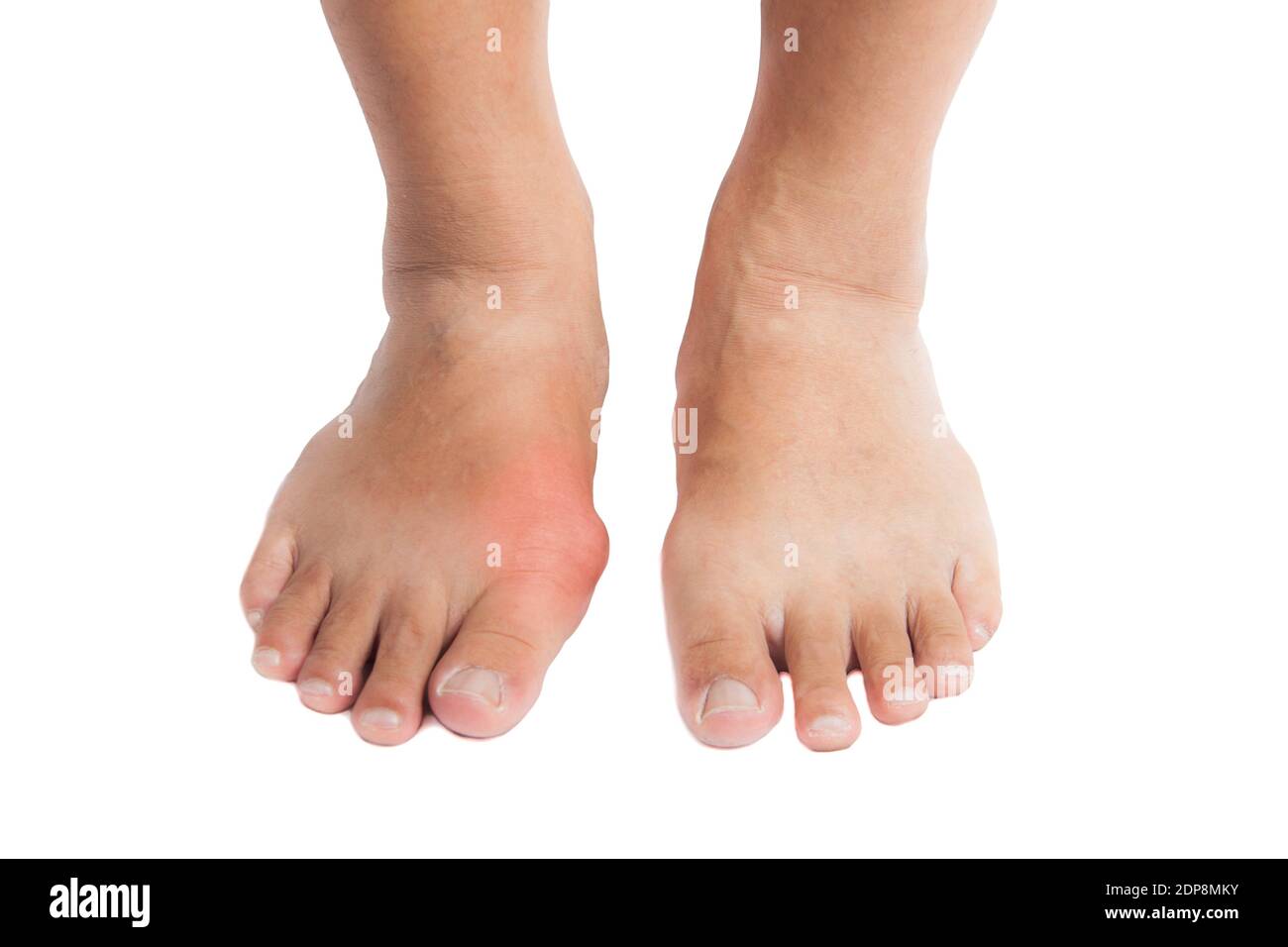 Human body leg Cut Out Stock Images & Pictures - Alamy