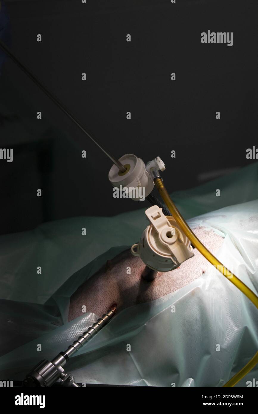 A vertical shot of a surgical process with surgical instruments on the ...