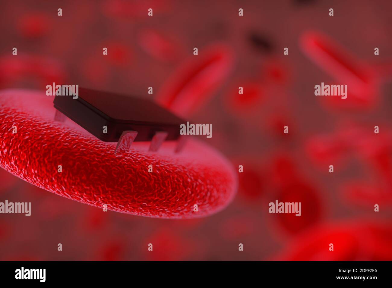 Implant chip human hi-res stock photography and images - Alamy