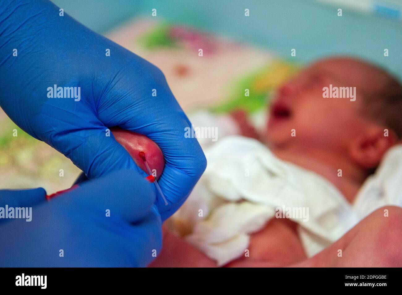 Newborn blood spot or heel prick test (the Guthrie test). A ...