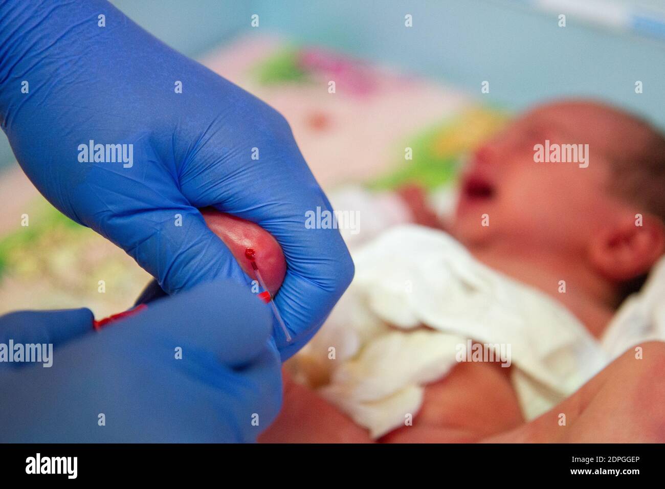 Newborn blood spot or heel prick test (the Guthrie test). A ...