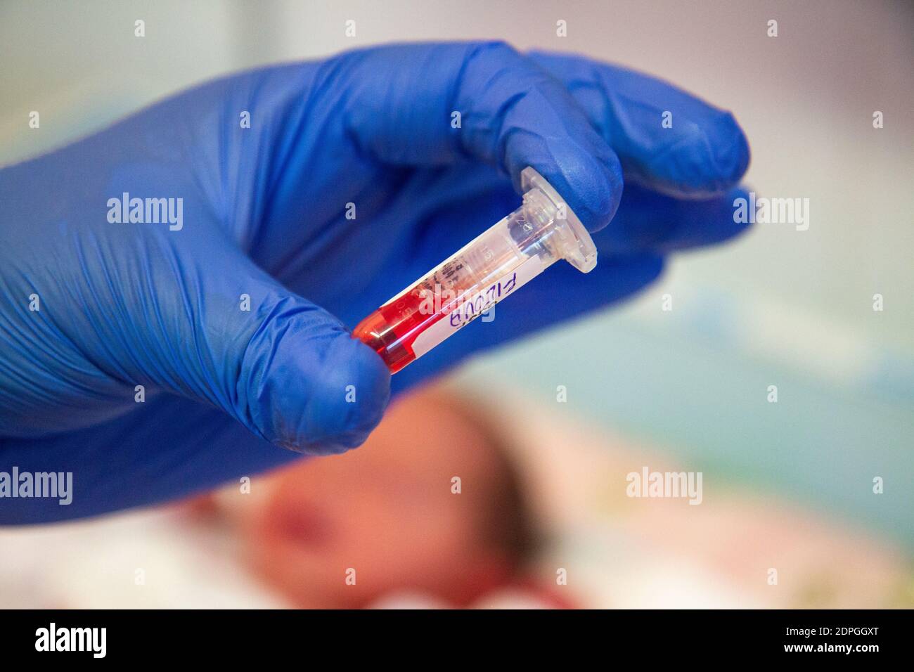 Newborn blood spot or heel prick test (the Guthrie test). A ...